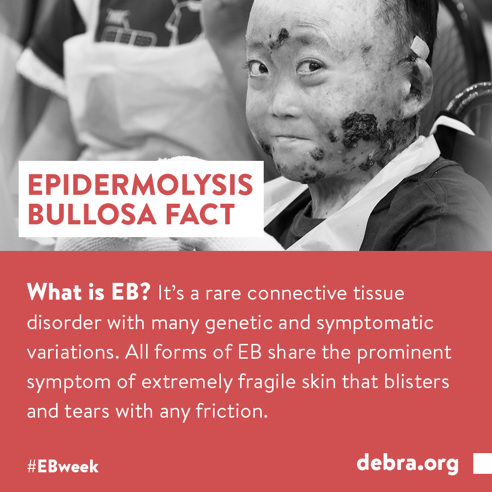 EB Awareness Week Social Media Toolkit | debra of America