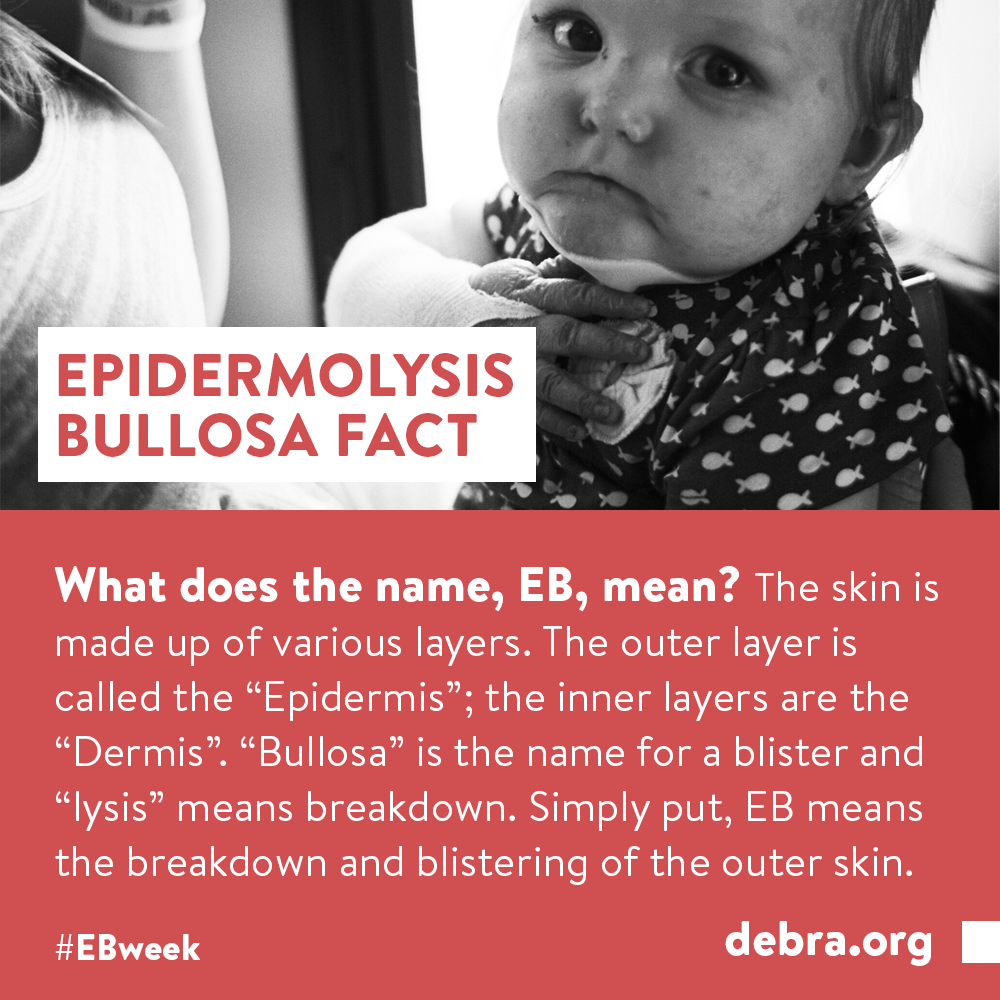 EB Awareness Week Social Media Toolkit | debra of America