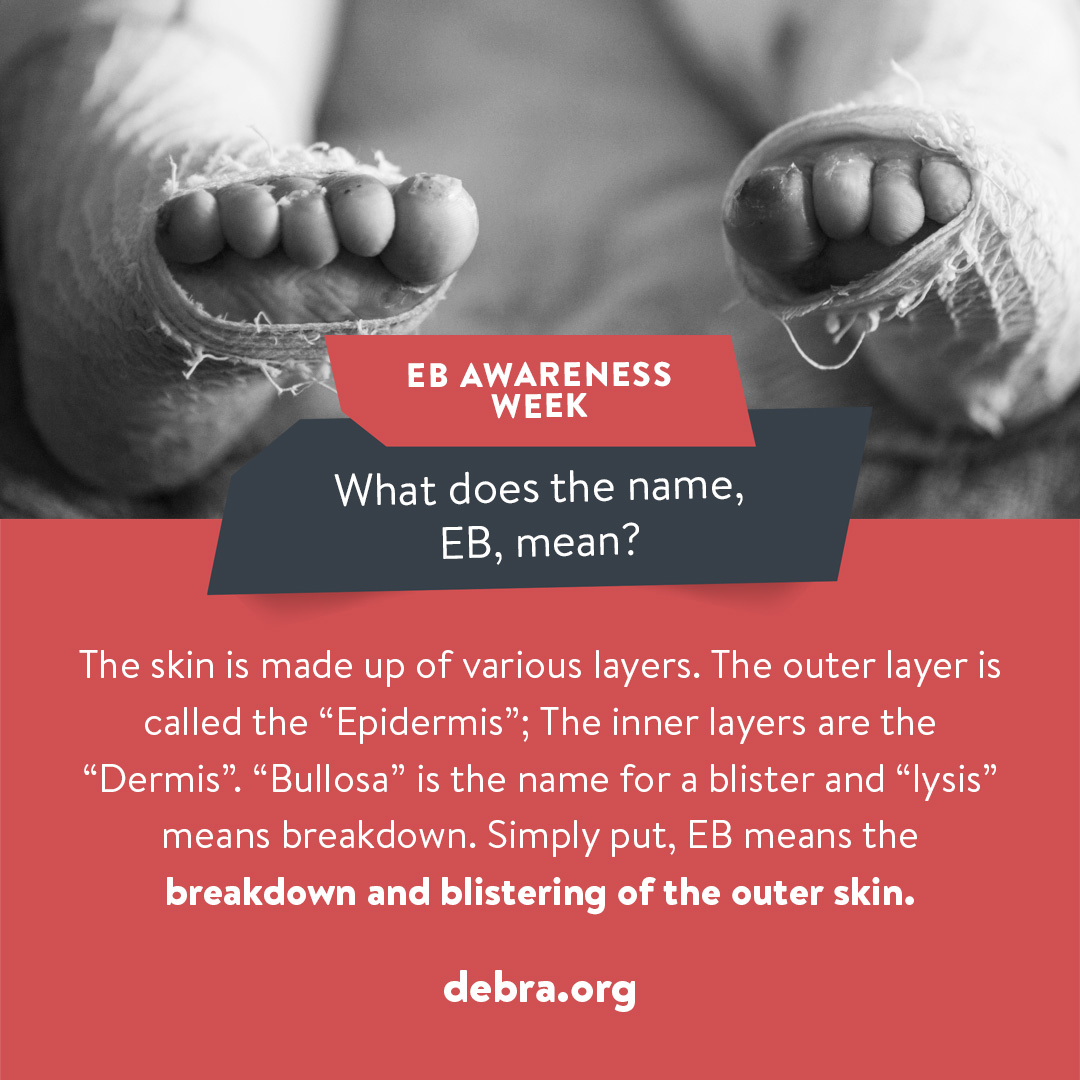 EB Awareness Week Social Media Toolkit | debra of America