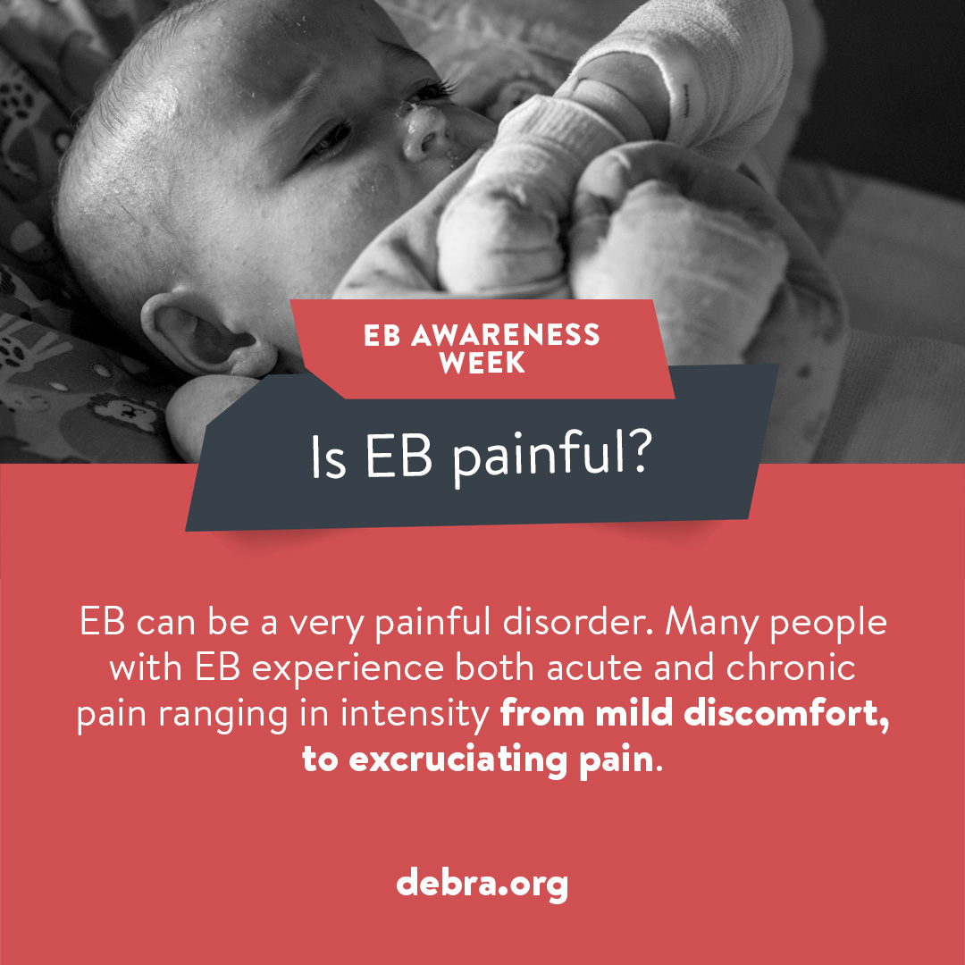 EB Awareness Week Social Media Toolkit | debra of America