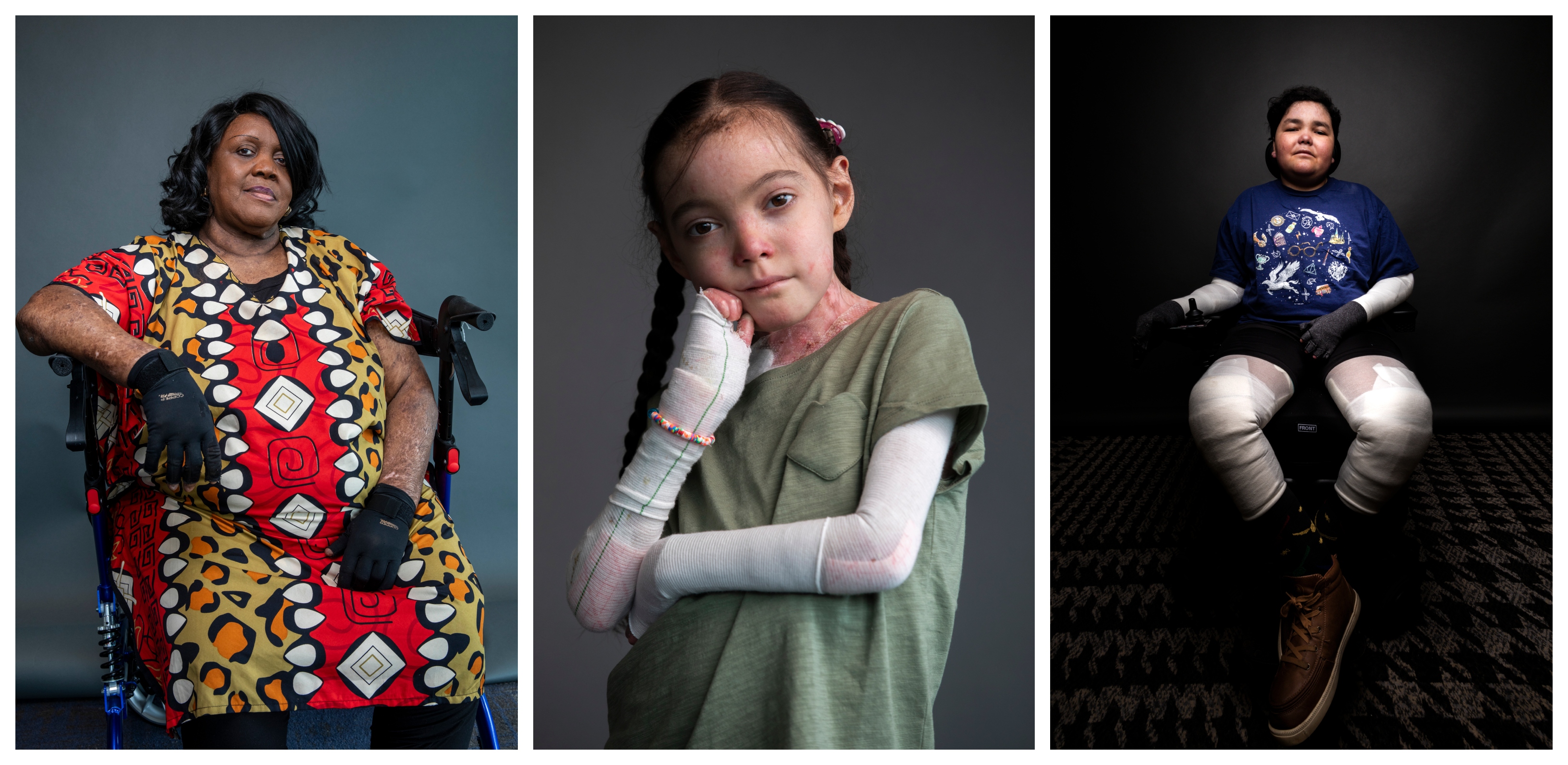 2024 EB Awareness Week Conversations | debra of America