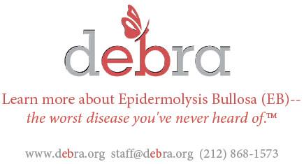 EB Cards | debra of America