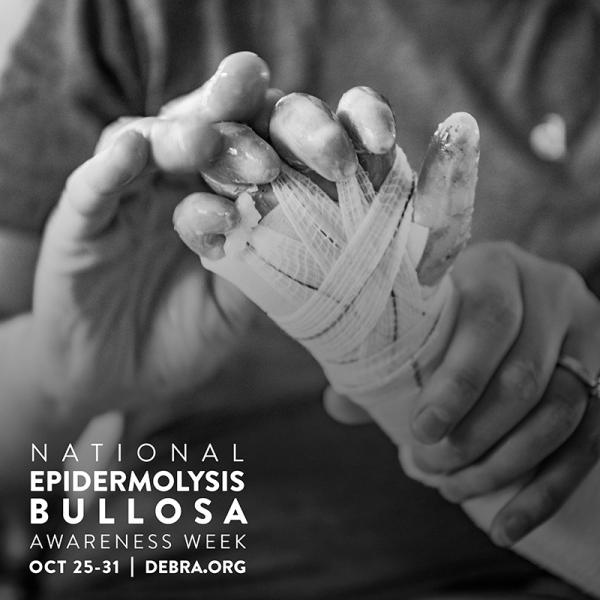 EB Awareness Week Social Media Toolkit | debra of America