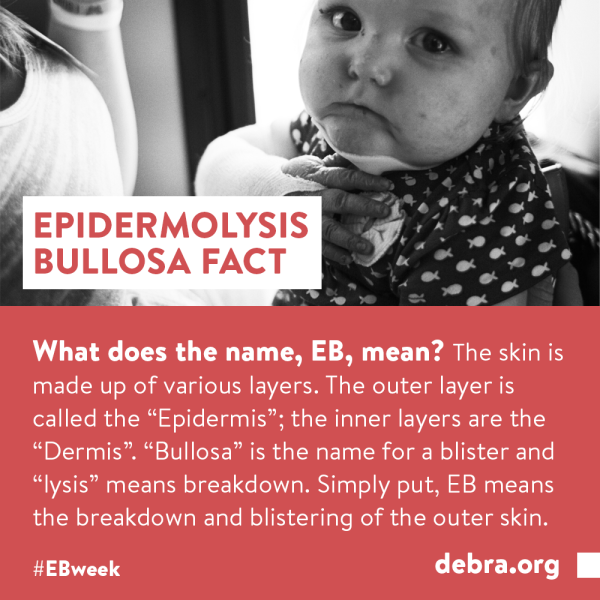 EB Awareness Week Social Media Toolkit | debra of America